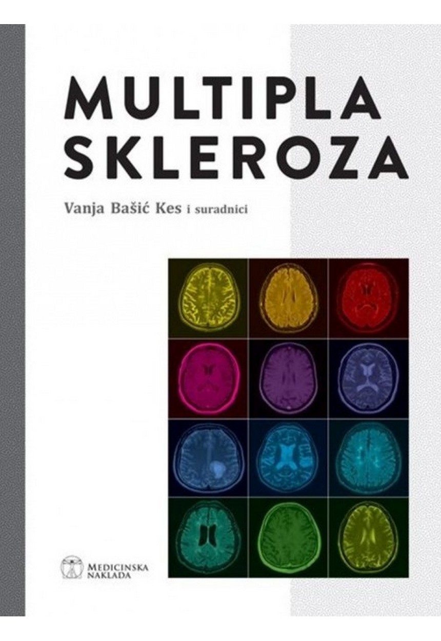 MULTIPLA SKLEROZA, Bašić Kes Vanja - Knjižara Dominović