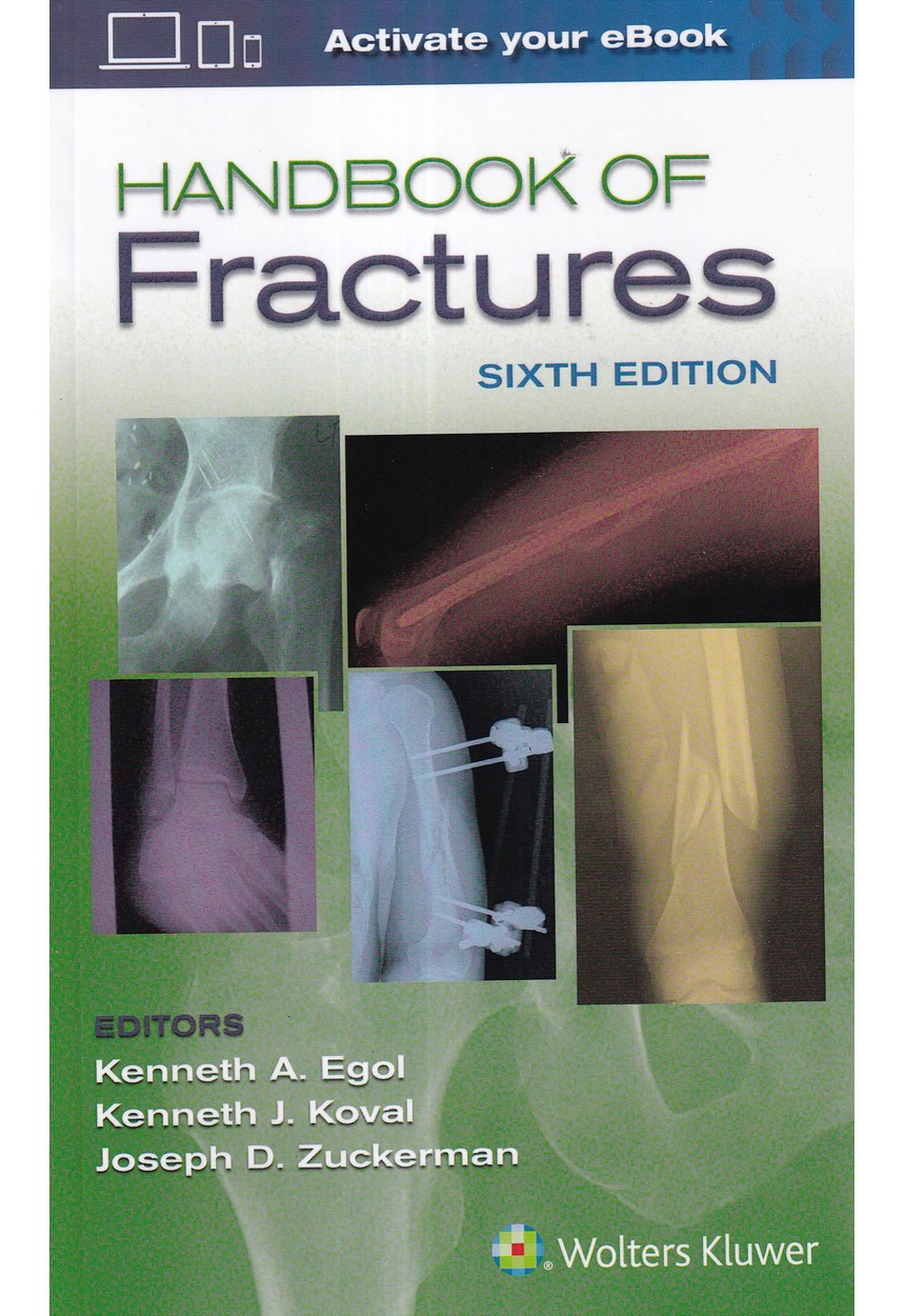 HANDBOOK OF FRACTURES, Koval Kenneth J.; Zuckerman, Joseph D., Egol ...
