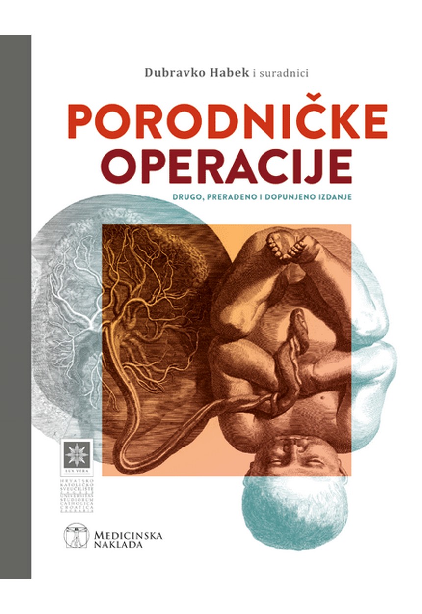 PORODNIČKE OPERACIJE, Habek Dubravko - Knjižara Dominović